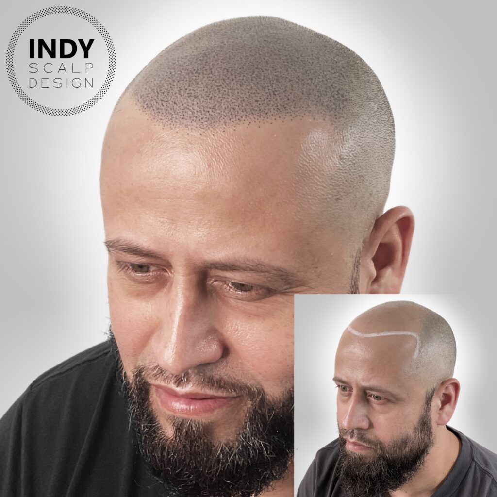 Indy Scalp Design